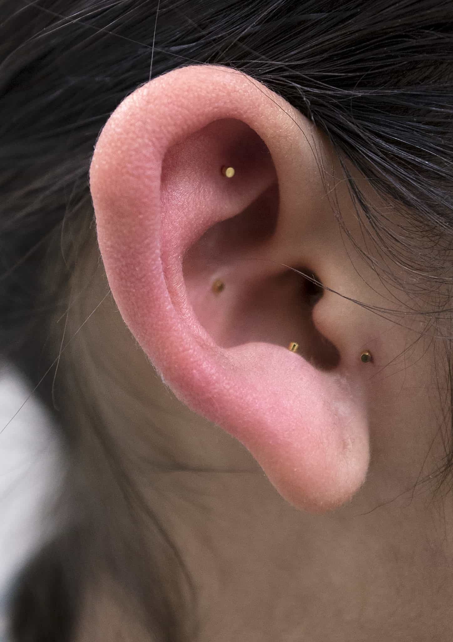 Ear Acupuncture Addiction